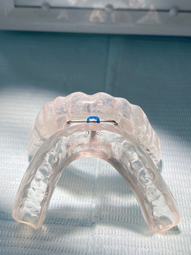 Javier Duran TTM Dolor orofacial y sueño